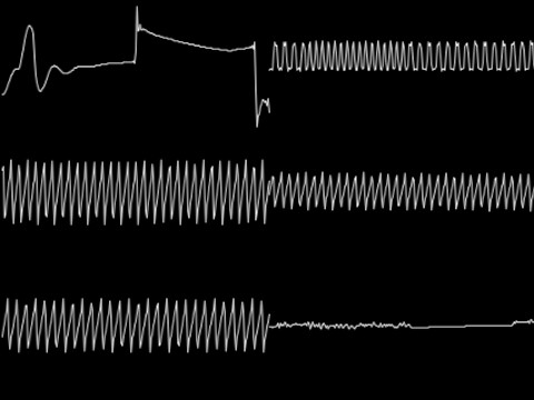 Eyes of Flame 2xSID-6581 Cover (OSCI)